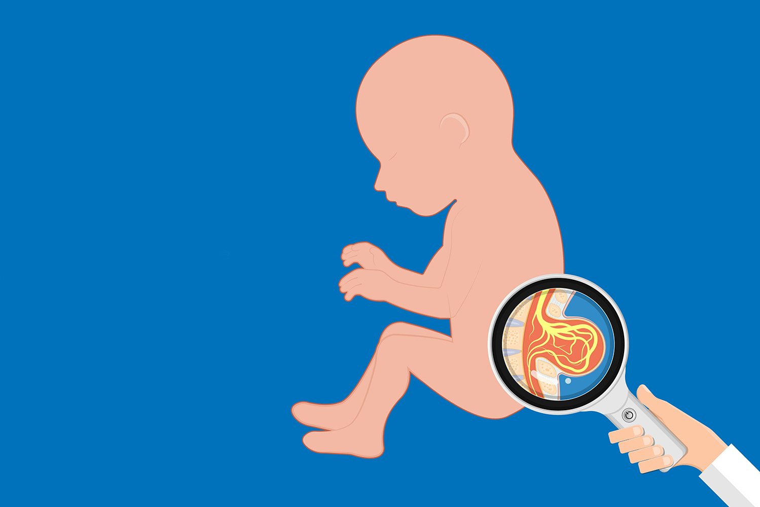 Spina Bifida - Kinetic Physical Therapy - Greenville, NC